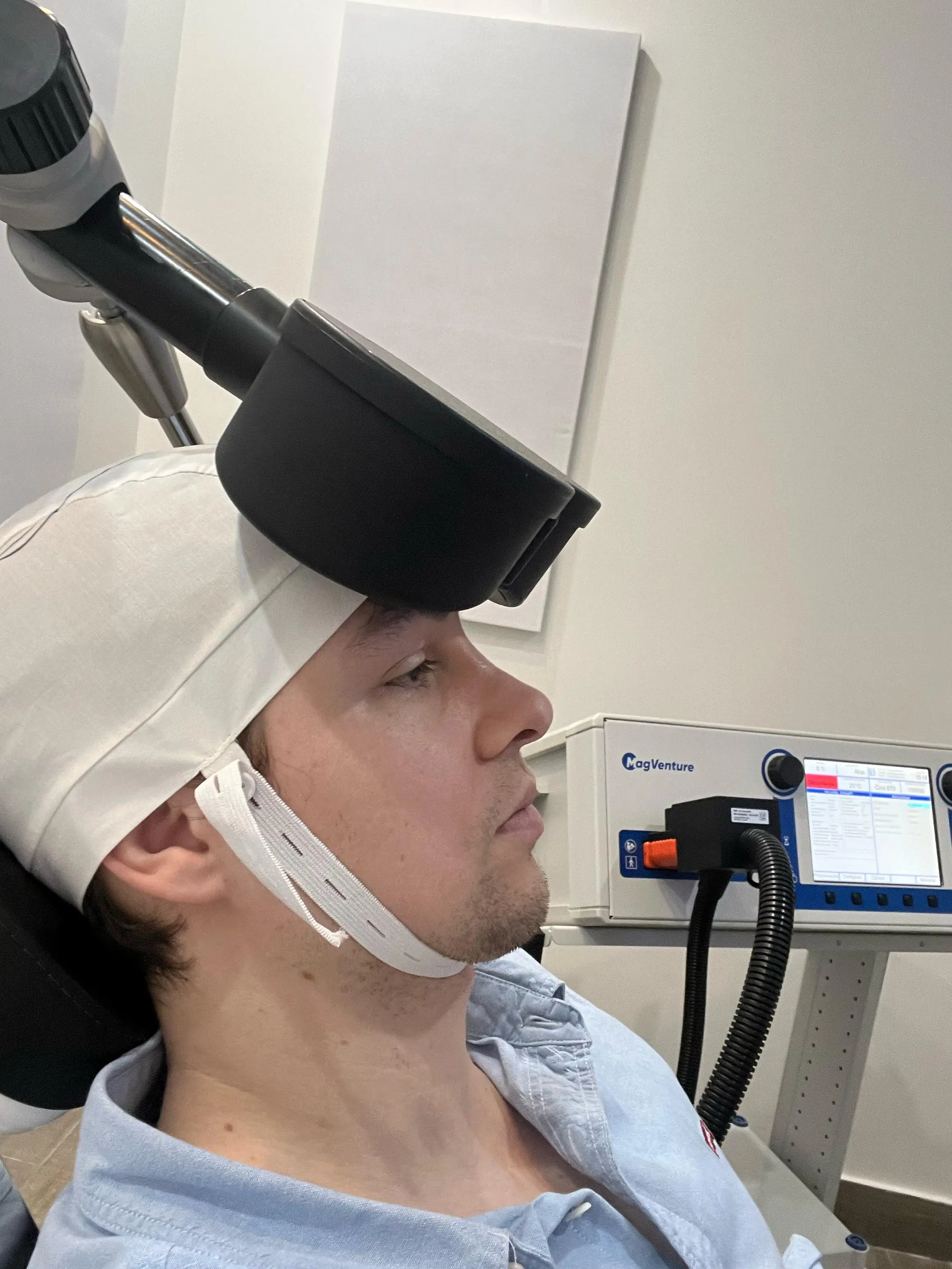 Tratamiento TMS en CABA | Estimulación Magnética Transcraneana en INBA